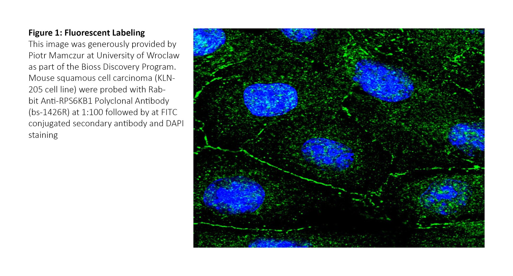 Fluorescent Vs Chromogenic Detection In Immunohistochemistry